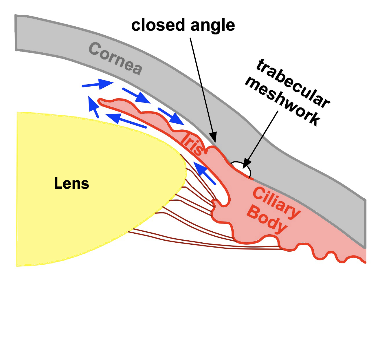 Ch 5 Glaucoma Risk Factors. A Patient's Guide to Glaucoma