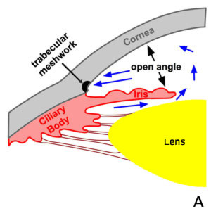 Ch 9. Glaucoma Emergency: Acute angle closure glaucoma. A Patient's ...